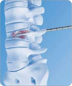 DePuy Synthes – Nexus Enterprises